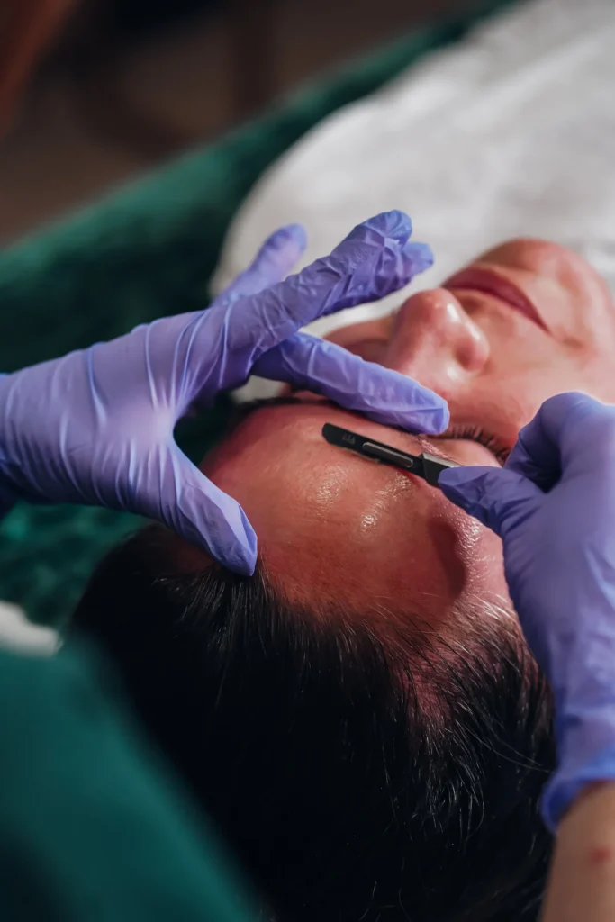 Best Dermaplaning Facials in Lee's Summit, MO